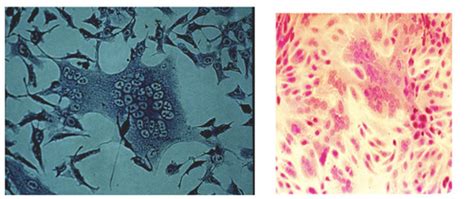 Viral Immune Evasion Flashcards Quizlet
