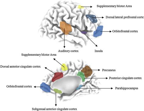 Brain Areas Showing Altered Resting State Eeg Oscillatory Activity In Download Scientific