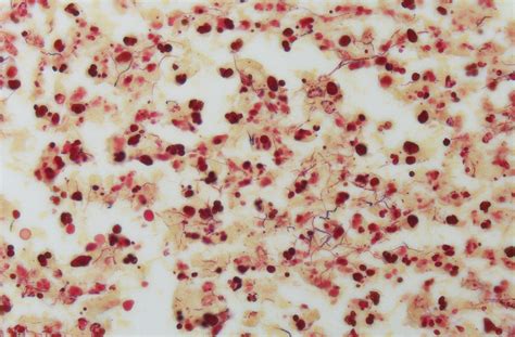 Filamentous Bacteria Problems And Solutions Water Treatment Plant Operators