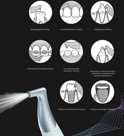 Whats A Prophy At Lara Roberts Blog