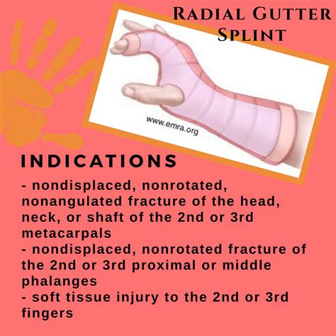 Radial Gutter Splint