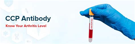 Ccp Antibody Test Know More About Your Arthritis Ganesh Diagnostic