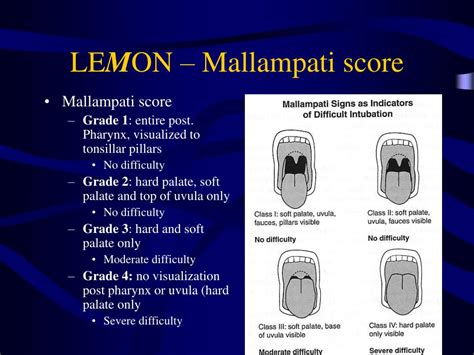 Ppt Airway Management Powerpoint Presentation Free Download Id 6722681