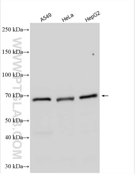 Sgk1 Antibody 28454 1 Ap Proteintech