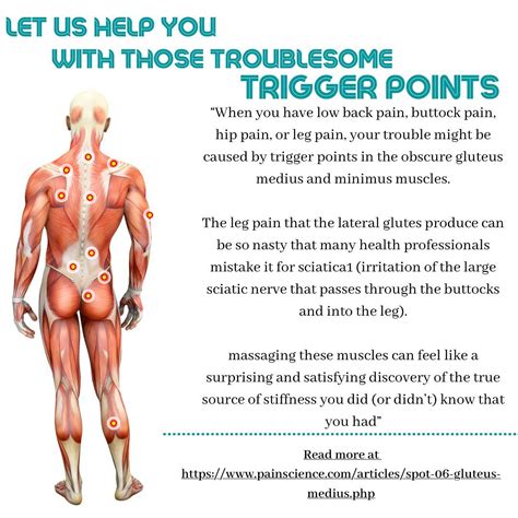 Gluteus Minimus Trigger Points