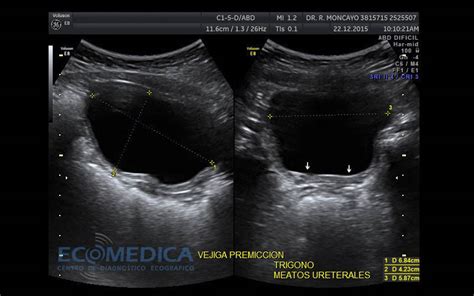 Echo Echocardiography Test Price In Delhi Easybook Mylab