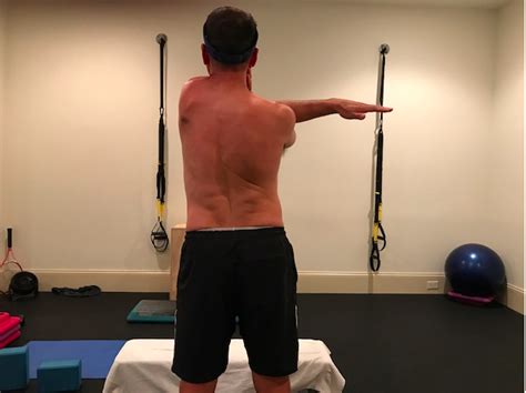 Uw Shoulder And Elbow Academy Ream And Run A Great Rehab Effort And Postoperative Range Of Motion