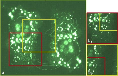 Simulated Sequence A A Maximum Projection Of A Sequence Containing