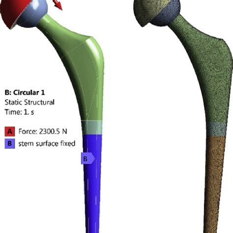 Pdf Static Structural Analysis Of Different Stem Designs Used In Total Hip Arthroplasty Using
