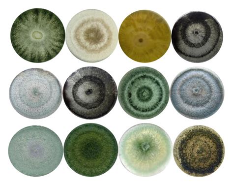 Colony Morphology Of Representative Trichoderma Isolates Grown On Pda Download Scientific Diagram