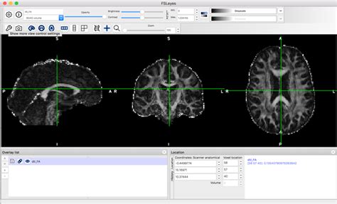 Diffusion Tensor Fitting And Tract Based Spatial Statistics Mri On Bear