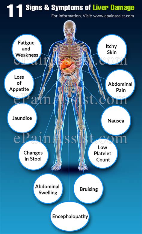 Liver Pain Symptoms Location