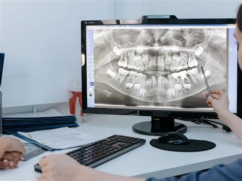 Flatiron Health的ai突破：精准且可分析的电子健康记录数据提取 Ai与医疗健康 家医大健康
