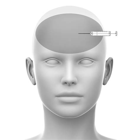 Neuromodulator Injection Techniques Online Course