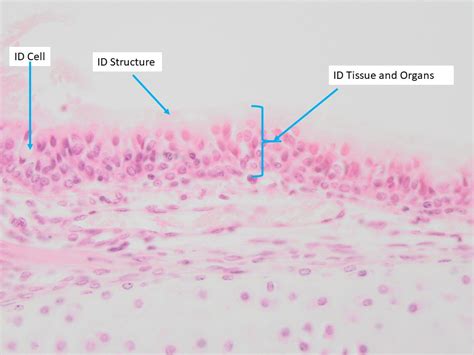 Stratified Squamous Epithelium 400x Labeled