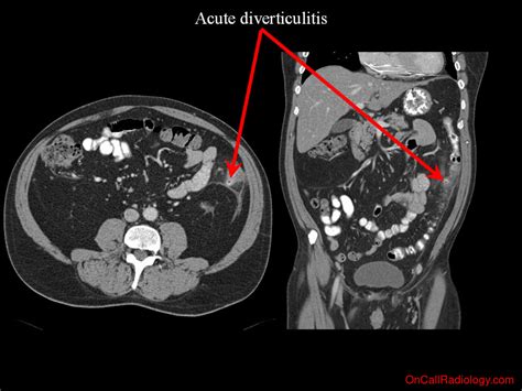 On Call Radiology Common Radiology Findings On Call And In The
