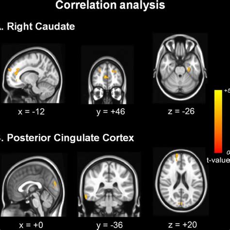 Comparison Of Functional Connectivity From The Right Caudate Nucleus Download Scientific
