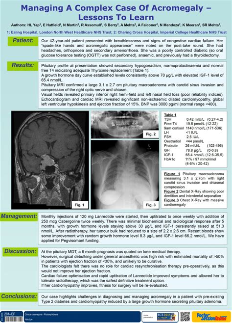 Pdf Managing A Complex Case Of Acromegaly Lessons To Learn