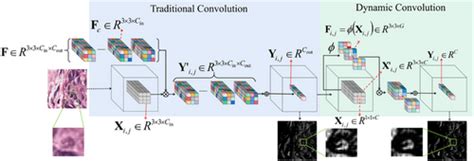 Segmentation Of Nucleus Based On Dynamic Convolution And Deep Features