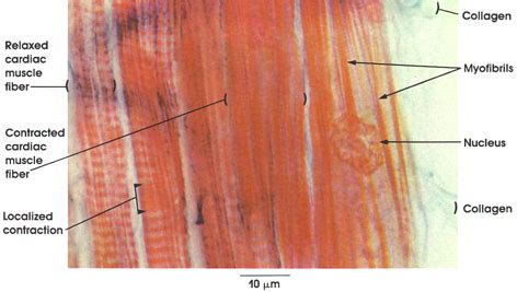 Plate Cardiac Muscle