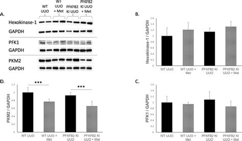 Glycolysis Plos One