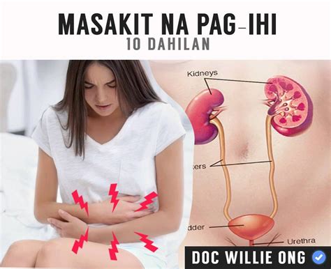 Masakit Na Pag Ihi 10 Dahilan Doc Willie Ong Defenders Facebook