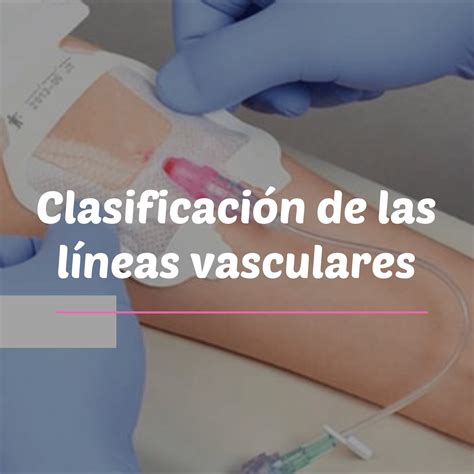 Elección De La Vena En La Canalización De Una Vía Periférica