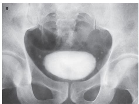 Radiographic Procedures Ii Urinary System Flashcards Quizlet