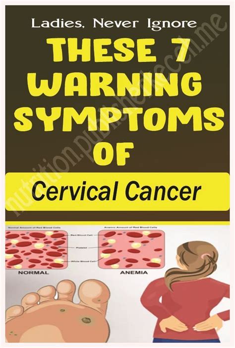 7 Warning Symptoms Of Artofit