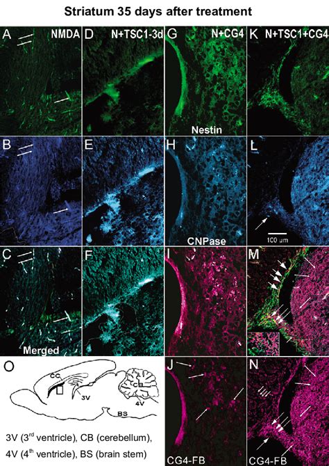Representative Views Of The Cc And Striatum 35 Days After Treatment Download Scientific