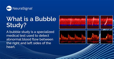 What Is A Bubble Study