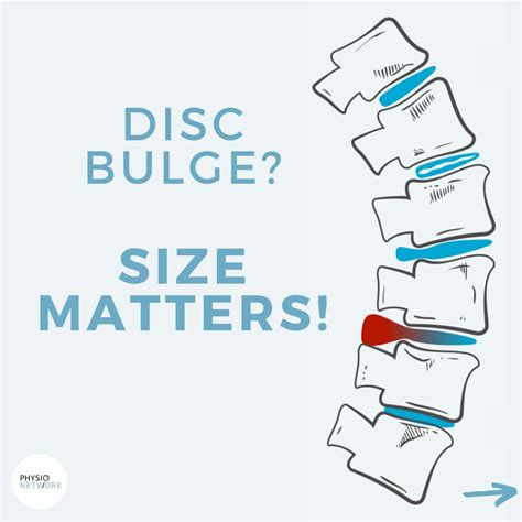 Kristopher Schultz Posted On Linkedin