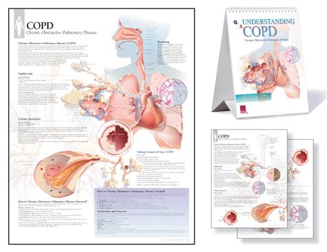 Understanding Copd Study Set Scientific Publishing