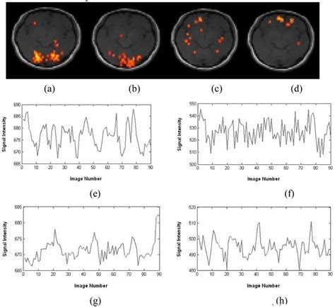Results In The Visual Cortex For The Real FMRI Test Of The Visual Download Scientific Diagram