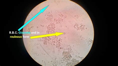 Fecal Wbc Prep With Stain