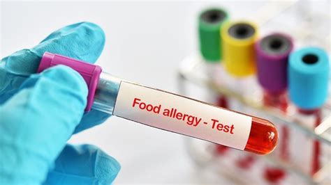 Juan Carlos Ivancevich On Linkedin Fda Warns About Anaphylaxis After False Negative Allergen Tests