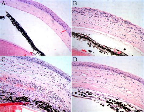 Histology Of The Mouse Eye After Induction Of Chemical Burns By 0 1 M