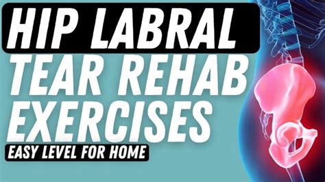 Home Rehab Strengthening Exercises For A Torn Labrum Mehmet Gem