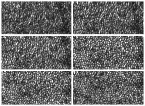 Selected En Face Projection Images During The Optimization Of Zernike Download Scientific