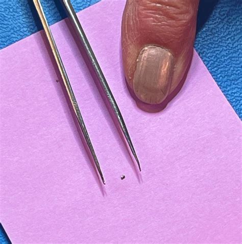 Detecto On Linkedin ⚡ Did You Know That The Smallest Component Our