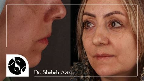 درباره کلینیک دکتر شهاب الدین عزیزی