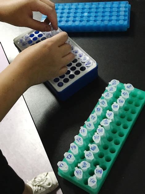 Page 13 Ema Binding Assay Images Free Download On Freepik
