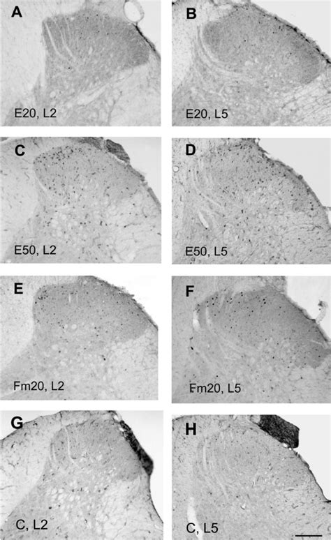 Rostrocaudal Distribution Of Fos Immunoreactive Fos Ir Neurons After Download Scientific