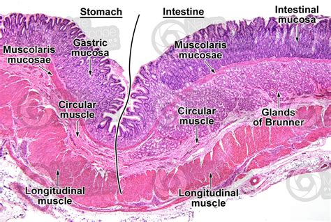 Pyloric Sphincter Histology