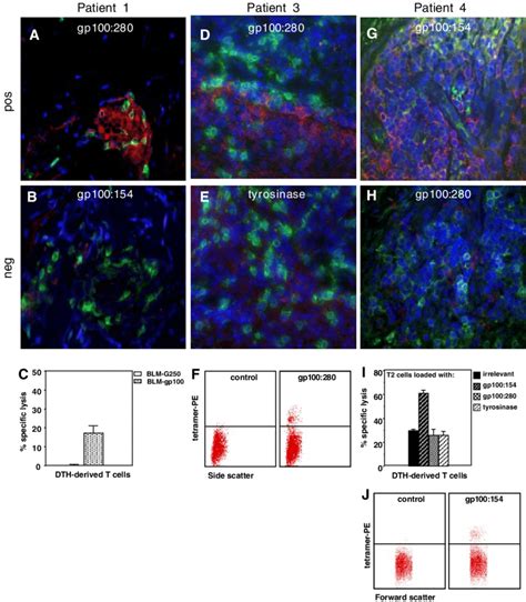 Comparison Of Mhc Class I Tetramer Staining In Situ And Mhc Class I Download Scientific Diagram