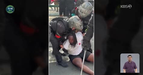 프랑스서 또 경찰 ‘과잉 진압 논란흑인남성 피해 호소