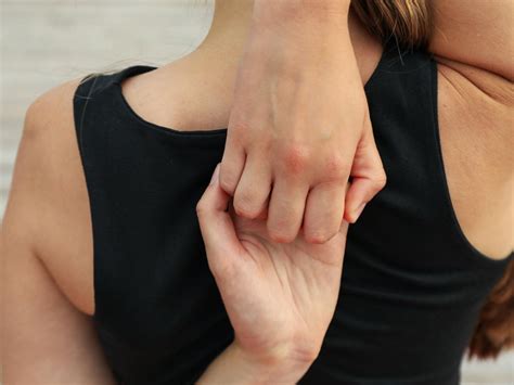 Best Pain Relief For Shingles Nerve Pain Dynamic Spine And Sport