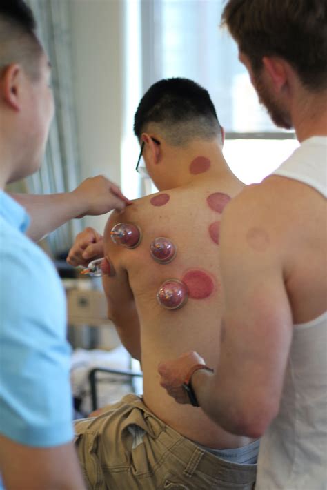 Myofascial Decompression Therapy Level 1 Course