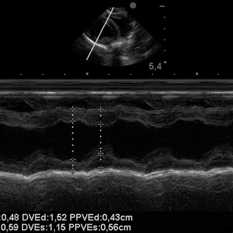 Echocardiographic Evaluation M Mode Left Ventricular Diameter Download Scientific Diagram