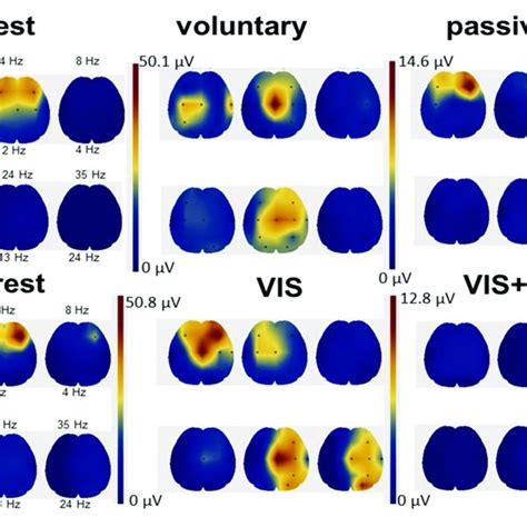 scalp topographic mapping of the frequency components of eeg activity
